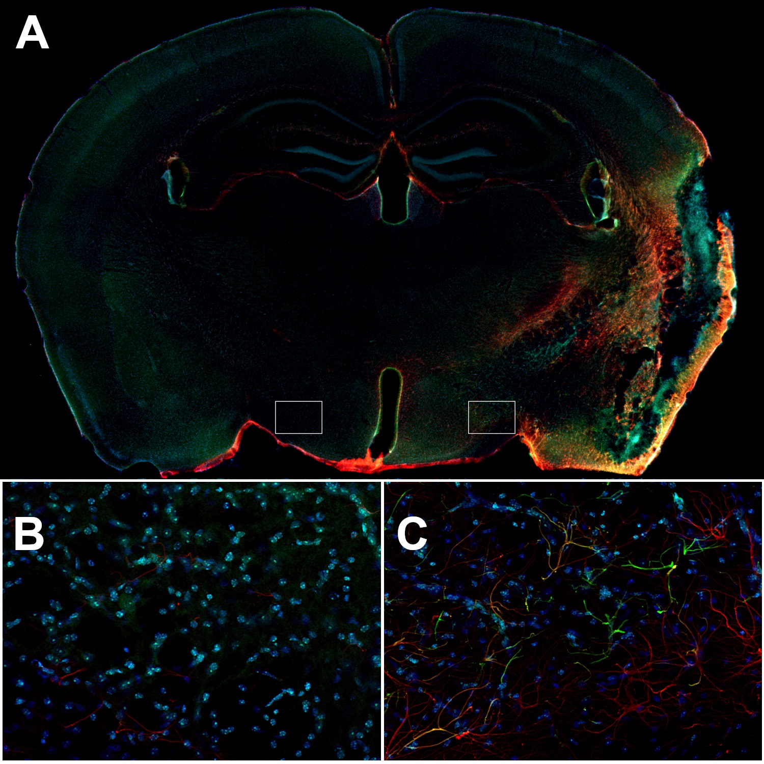 Battle In The Brain Neuroinflammation